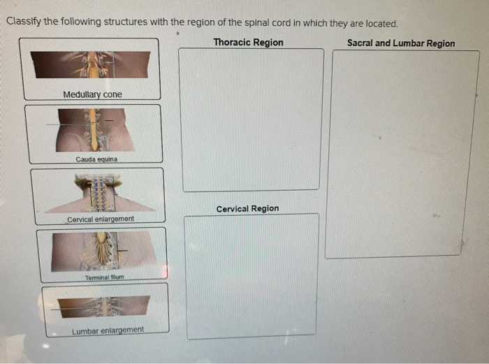 Solved Classify the following structures with the region of | Chegg.com