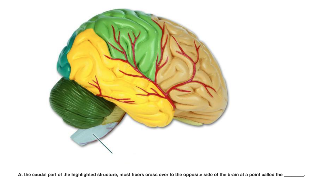 Solved At the caudal part of the highlighted structure, | Chegg.com