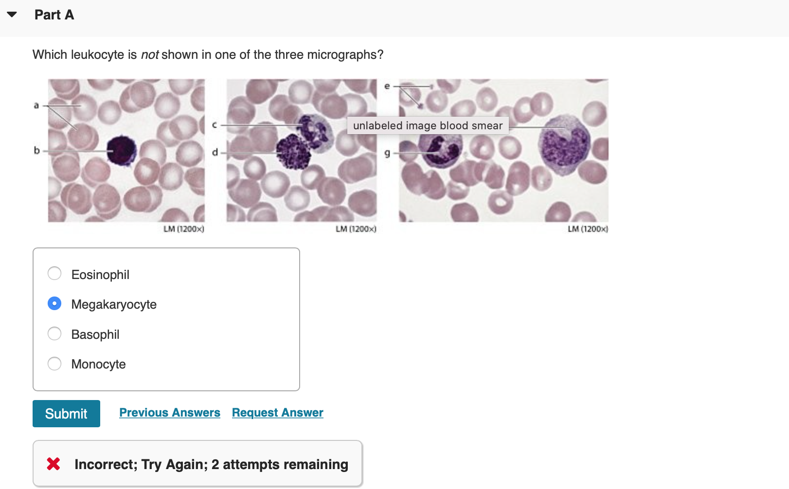 Solved Part A Which leukocyte is not shown in one of the | Chegg.com