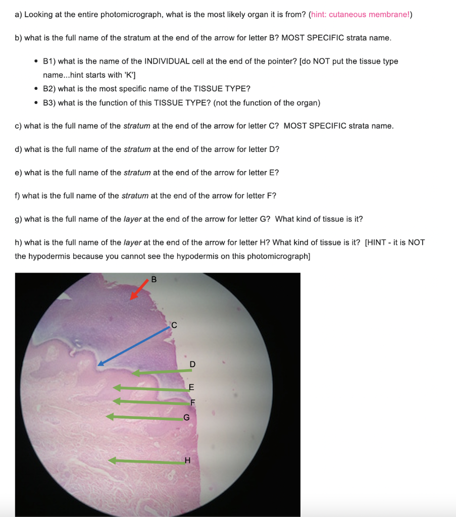 Solved a) Looking at the entire photomicrograph, what is the | Chegg.com