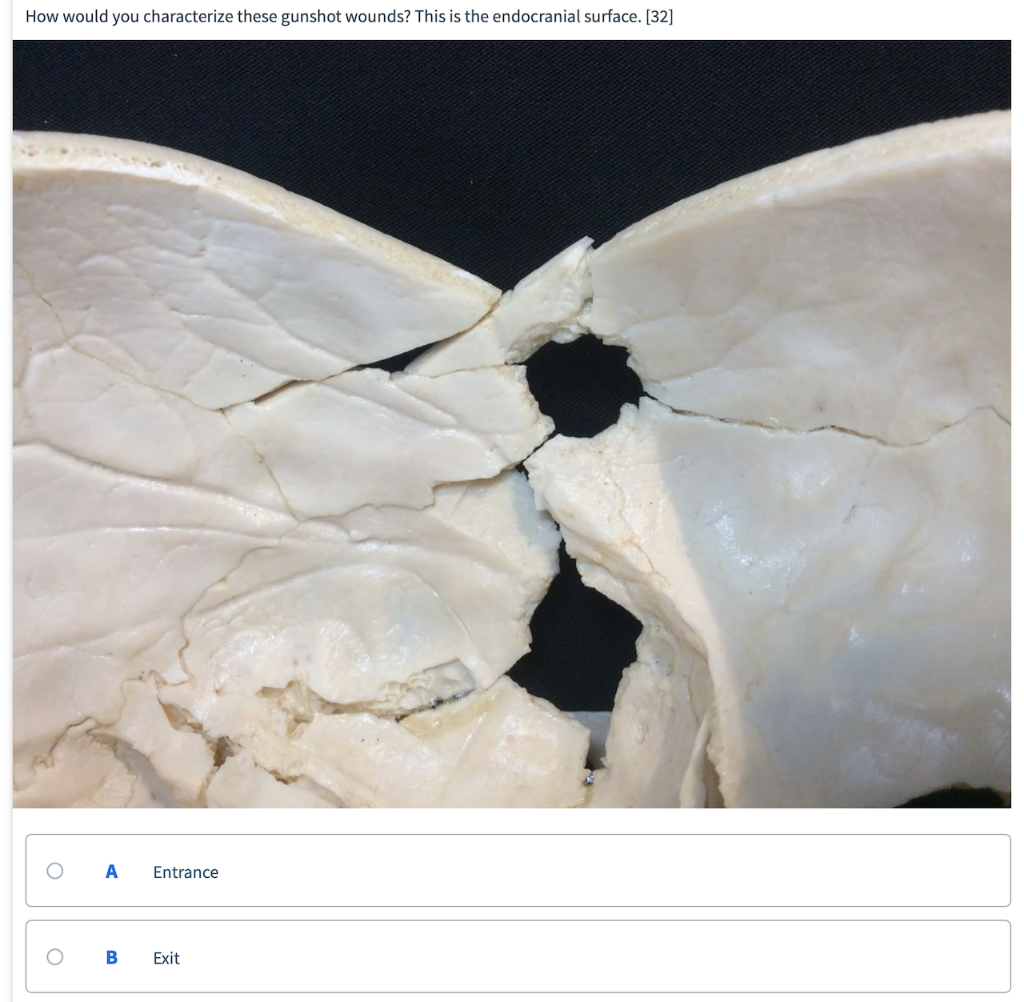 Solved and which type of secondary fractures are present? | Chegg.com