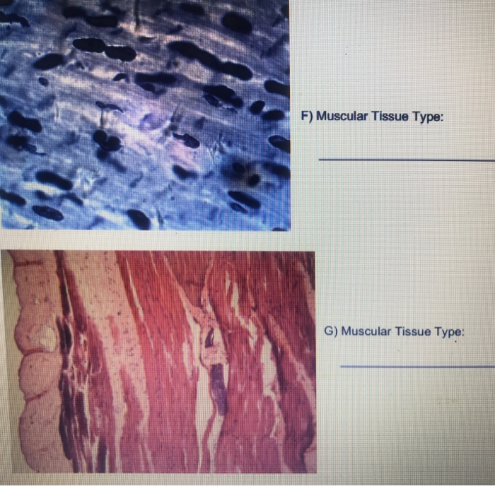 Solved H- Click here to enter text. A) Epithelial Tissue | Chegg.com