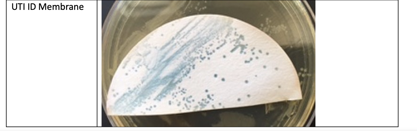 Solved Steps for performing a UTI ID experiment? These are | Chegg.com