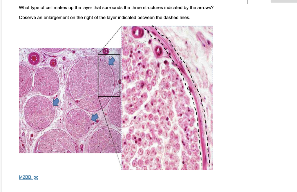 Solved What type of cell makes up the layer that surrounds | Chegg.com