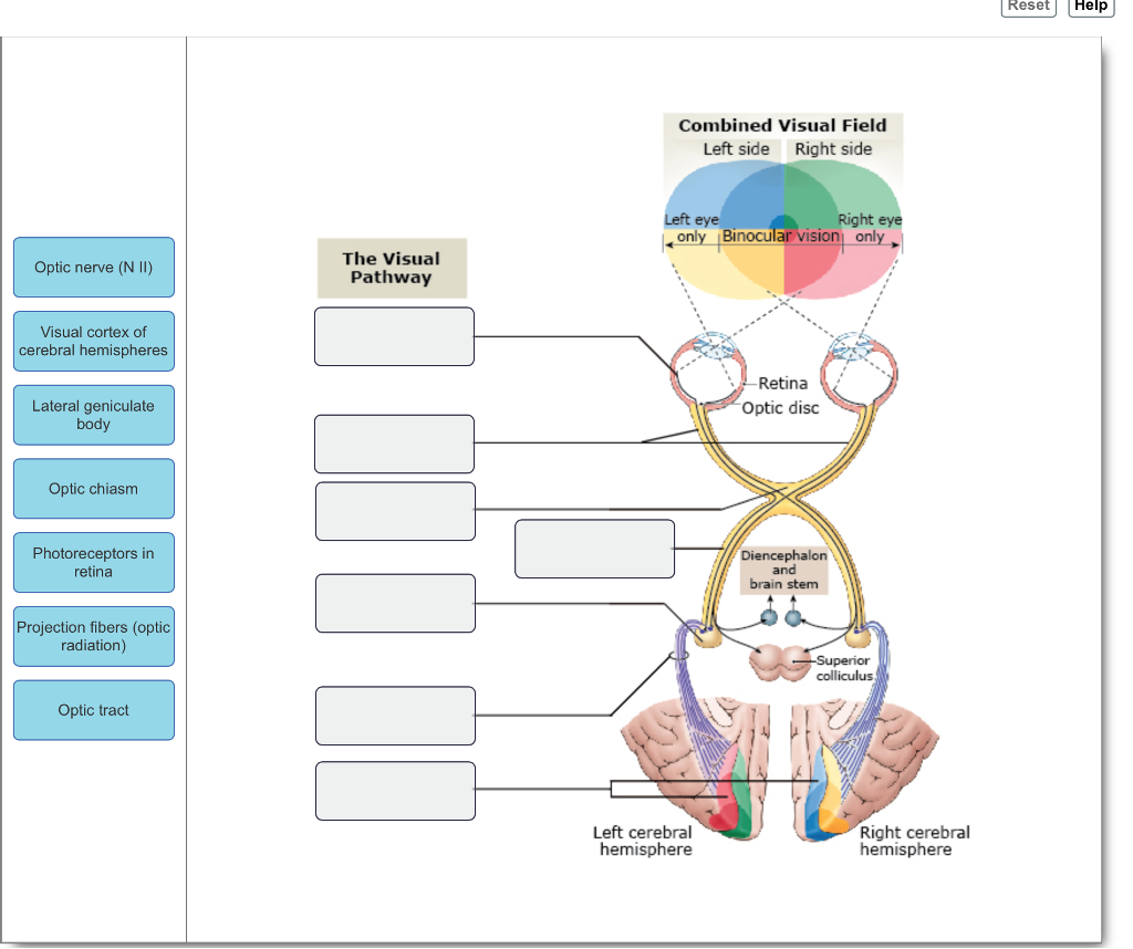 Solved Reset Help Combined Visual Field Left side Right side | Chegg.com