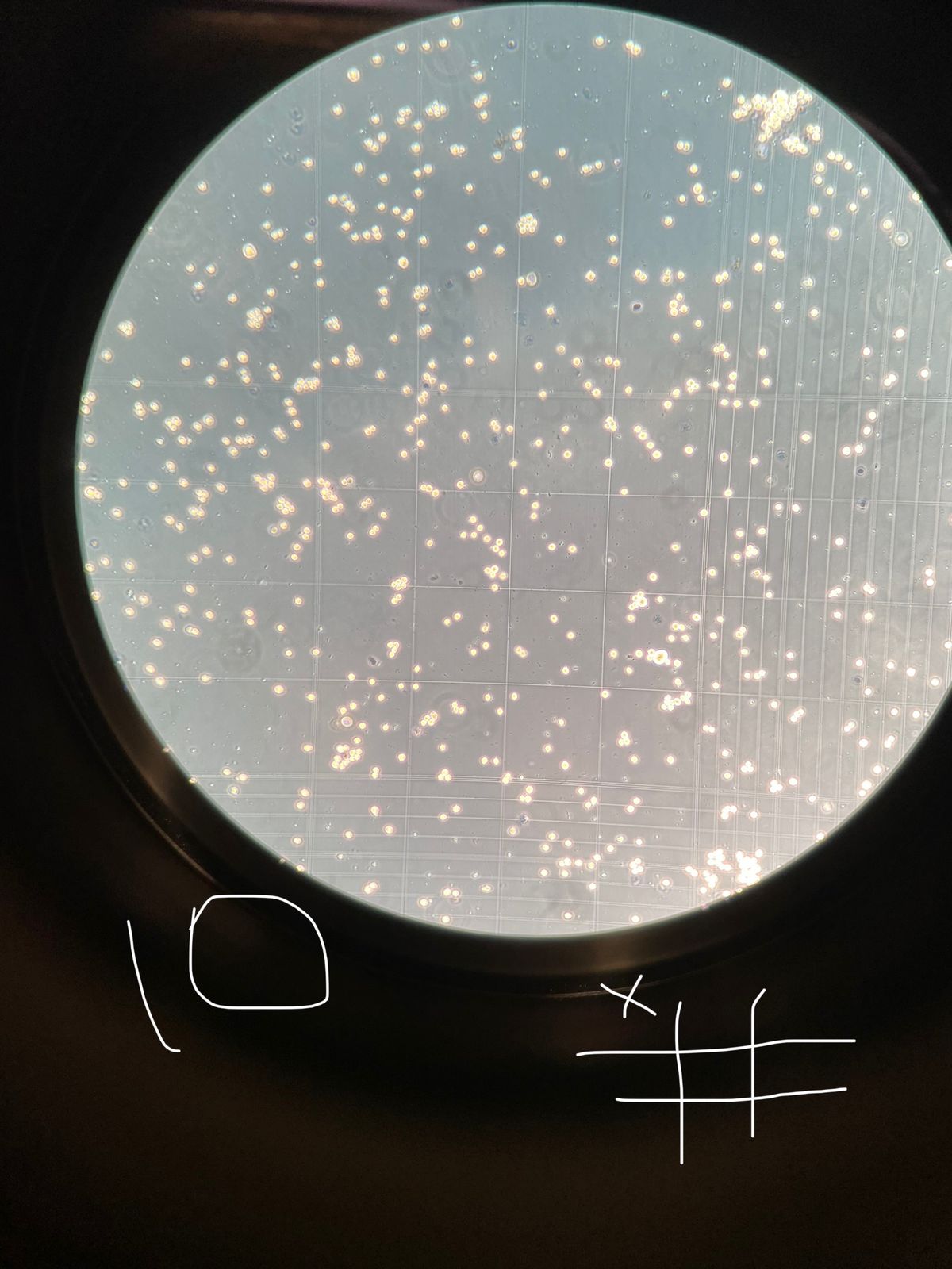 Counting trypsinized cells (with 5% & 10% ethanol) on | Chegg.com