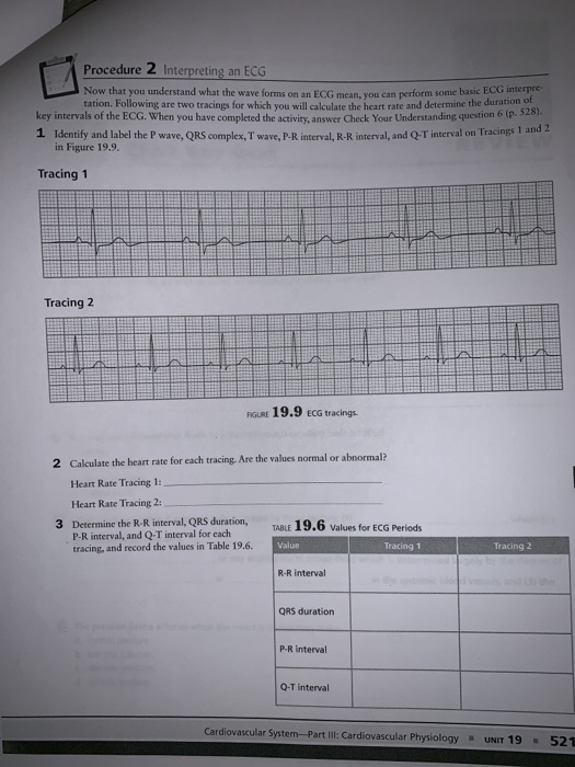 Solved Pre-Lab Exercise 19-2 Autonomic Nervous System and | Chegg.com