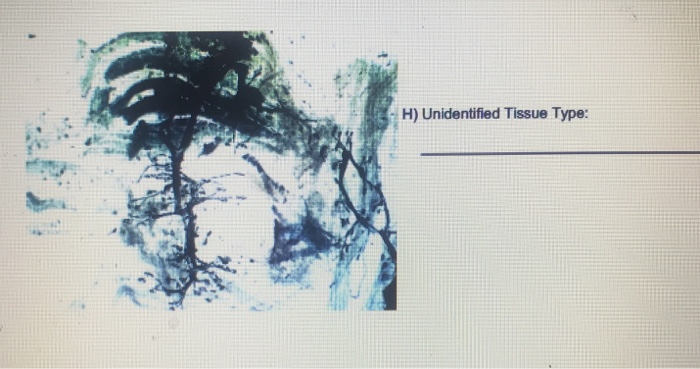 Solved H- Click here to enter text. A) Epithelial Tissue | Chegg.com