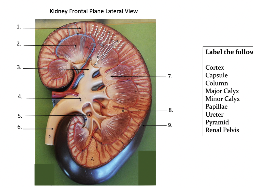 Solved Kidney Lateral View Vidnn, Crontal Dlonn I atoml | Chegg.com
