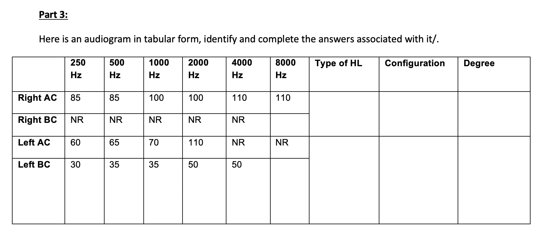 Solved Here is an audiogram in tabular form, identify and | Chegg.com