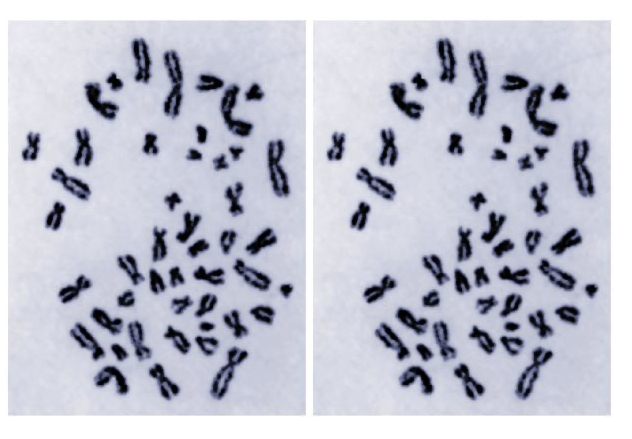 Solved } 产 3 The microscope image above shows the human | Chegg.com