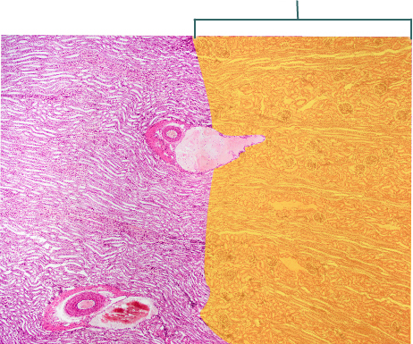 Solved PAL: Histology > Urinary System > Lab Practical | Chegg.com