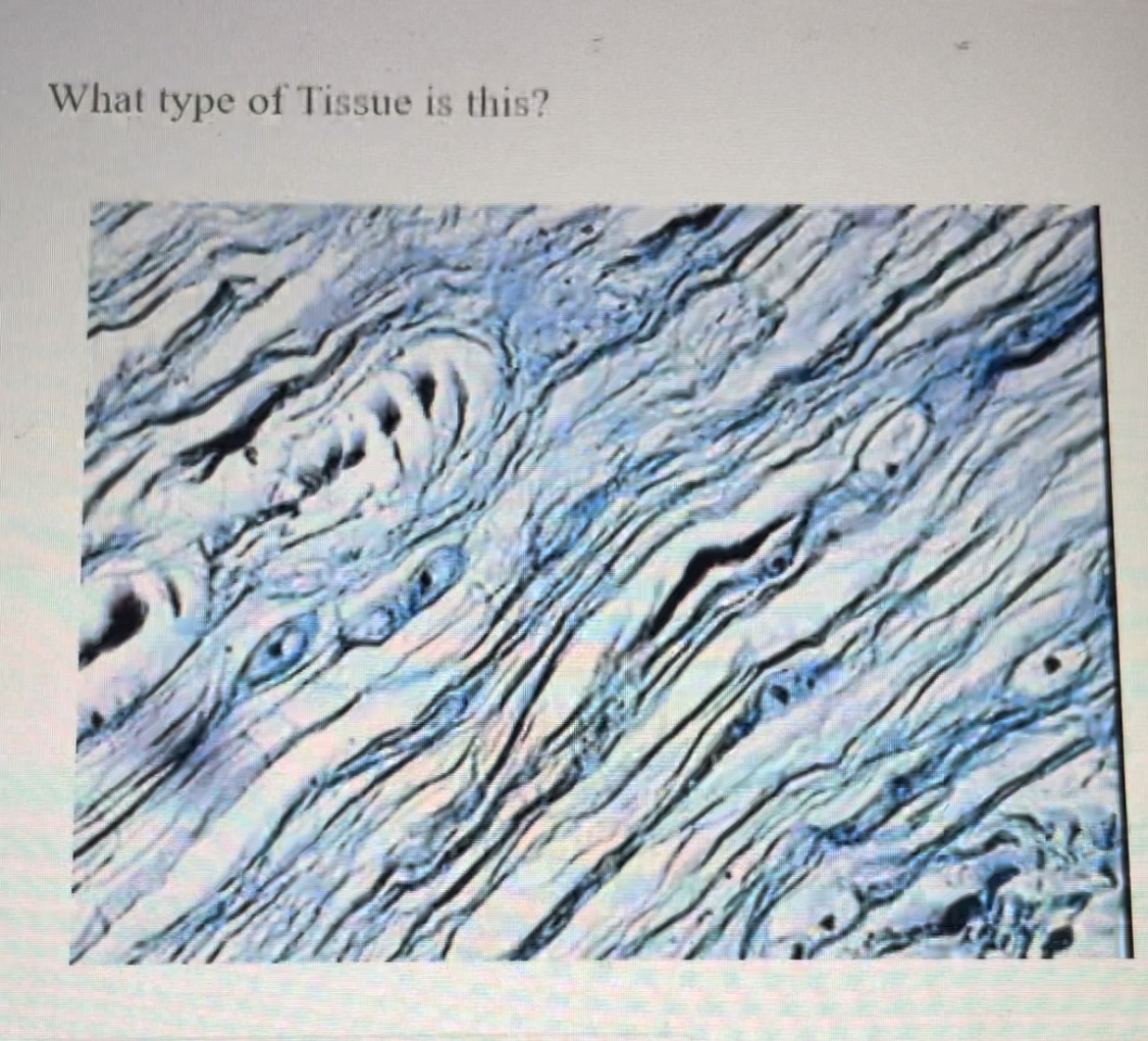 solved-what-type-of-tissue-is-this-chegg
