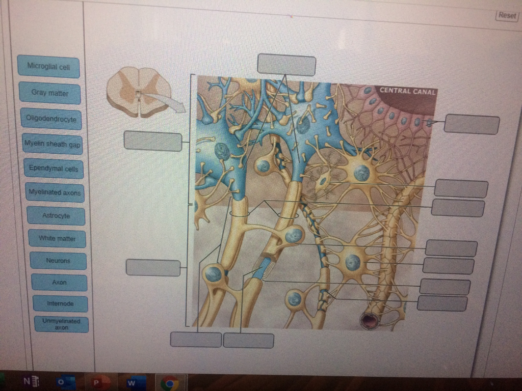 Solved Reset Microglial cell Gray matter CENTRAL CANAL | Chegg.com