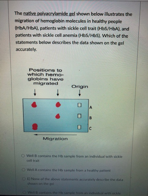Solved The native polyacrylamide gel shown below illustrates | Chegg.com