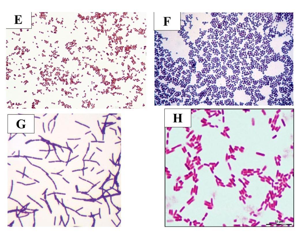 Solved Identify bacterial type, gram stain and arrangement | Chegg.com