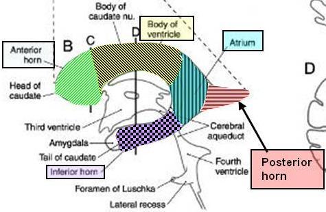 Surface Anatomy Of Trigone Of Ventricle