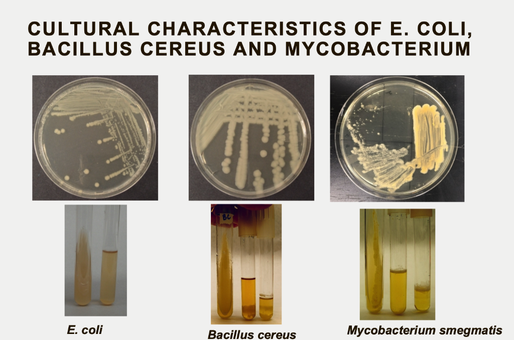 Solved CULTURAL CHARACTERISTICS OF E. COLI, BACILLUS CEREUS | Chegg.com