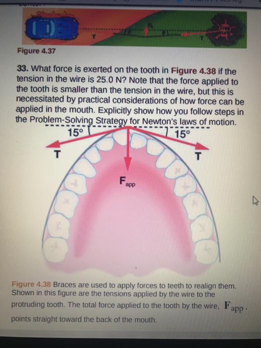 Solved Figure 4.37 33. What force is exerted on the tooth in | Chegg.com