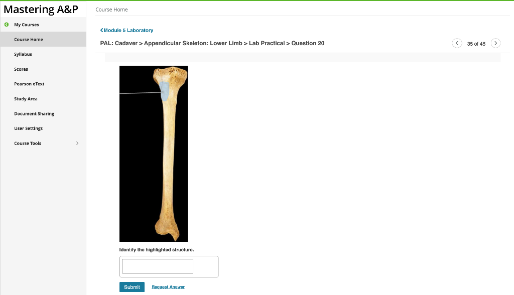 Solved PAL: Cadaver > Appendicular Skeleton: Lower Limb > | Chegg.com Solved PAL: Cadaver > Appendicular Skeleton: Lower Limb > | Chegg.com