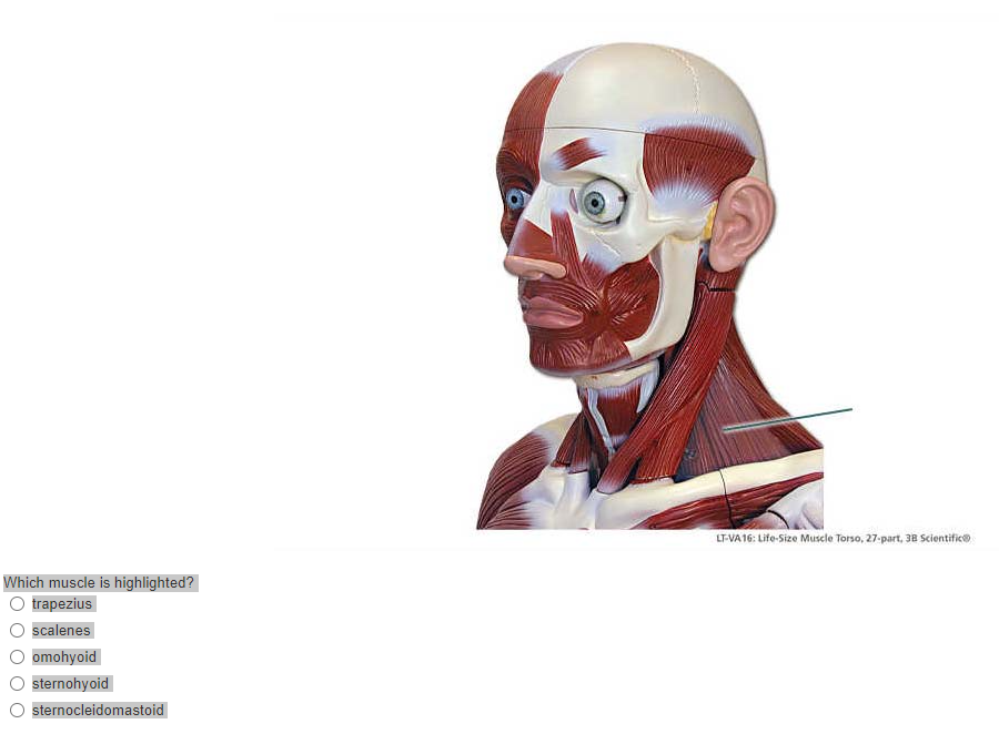 Solved LT-VA 16: Life-Size Muscle Torso, 27.part, 3B | Chegg.com