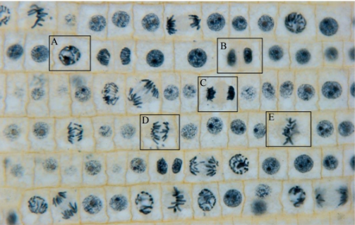 Solved In the light micrograph below of dividing cells near | Chegg.com