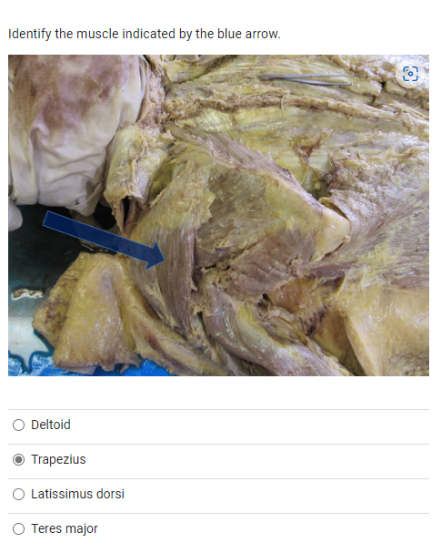 Solved Identify the muscle indicated by the blue arrow. | Chegg.com