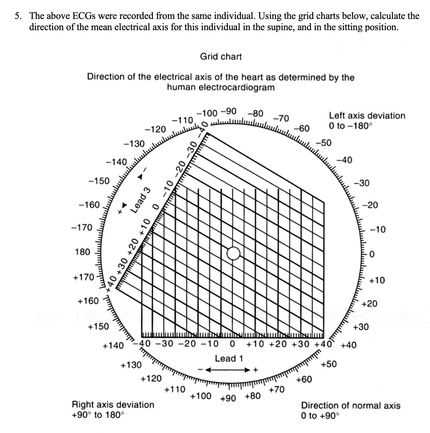 Solved Supine Sitting 5. The above ECGs were recorded from | Chegg.com