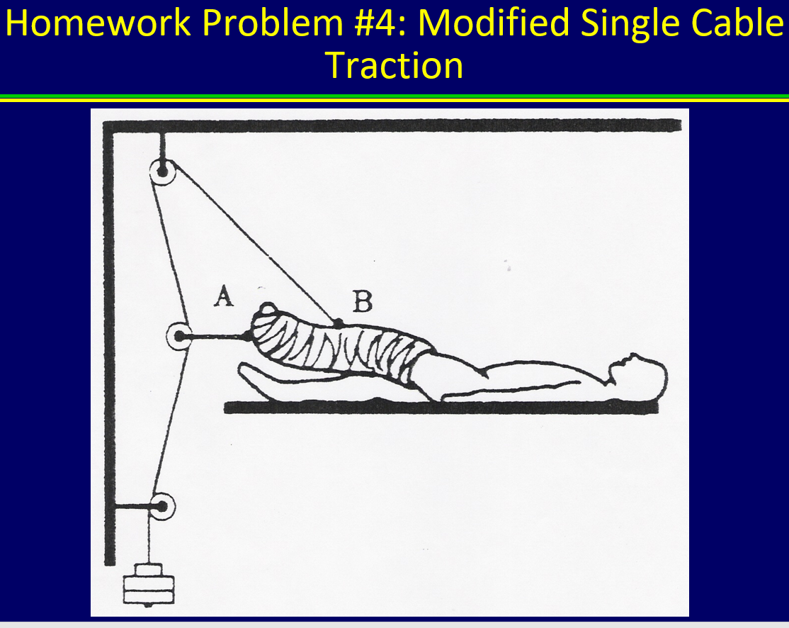 Solved Homework Problem #4: Modified Single Cable Traction • | Chegg.com