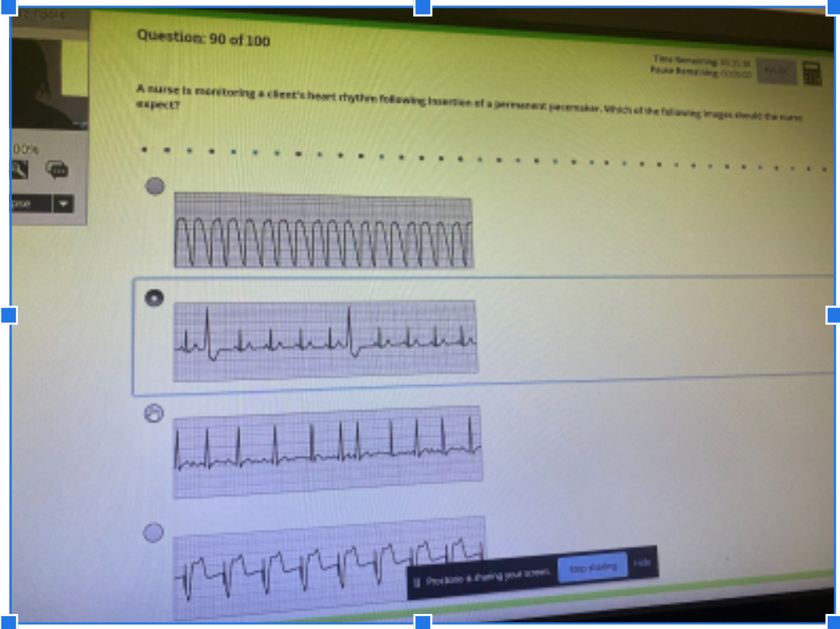 Solved A nurse is monitoring a client's heart rhythm | Chegg.com