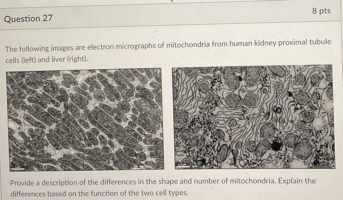Solved The following images are electron micrographs of | Chegg.com