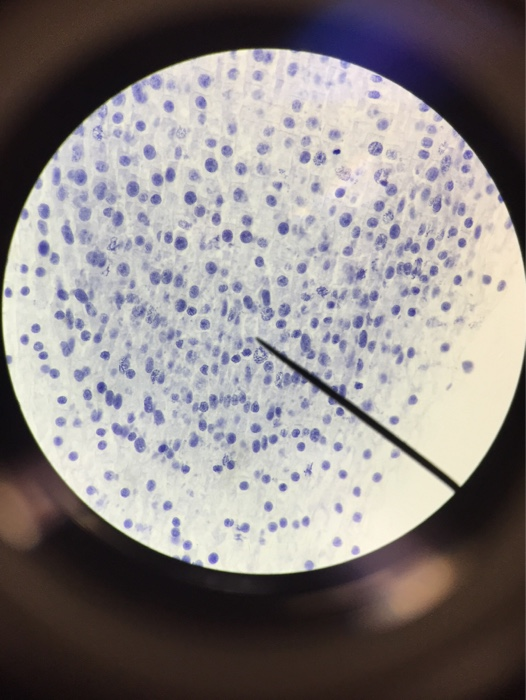 Solved Allium (Onion) Root tip At 400X total magnification, | Chegg.com