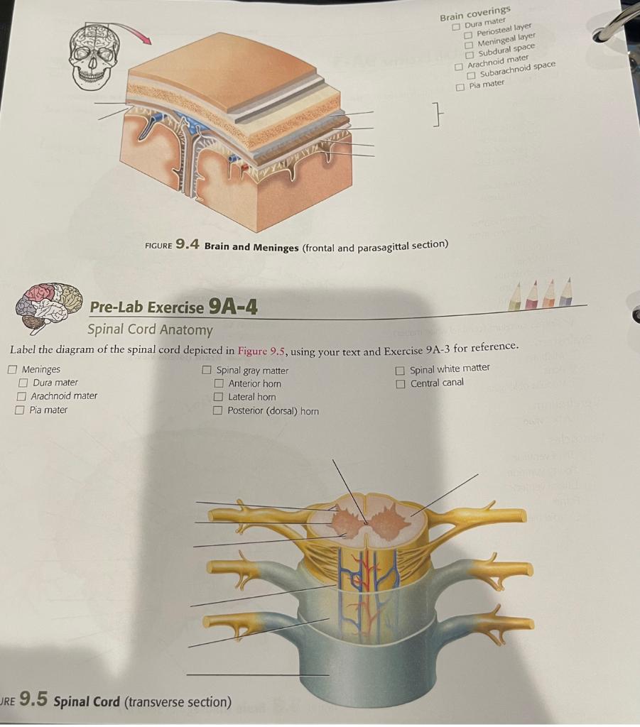 Solved SS Brain coverings Dura mater Periosteal layer | Chegg.com