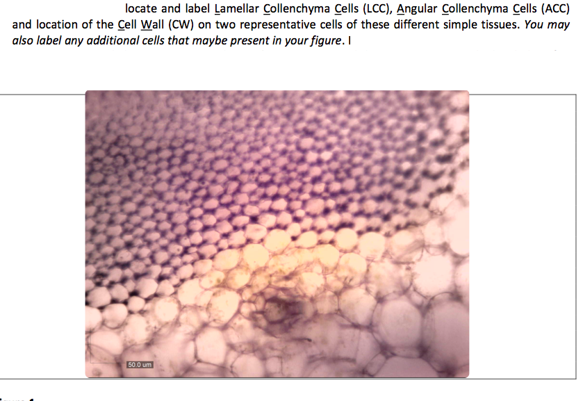 Solved locate and label Lamellar Collenchyma Cells (LCC), | Chegg.com