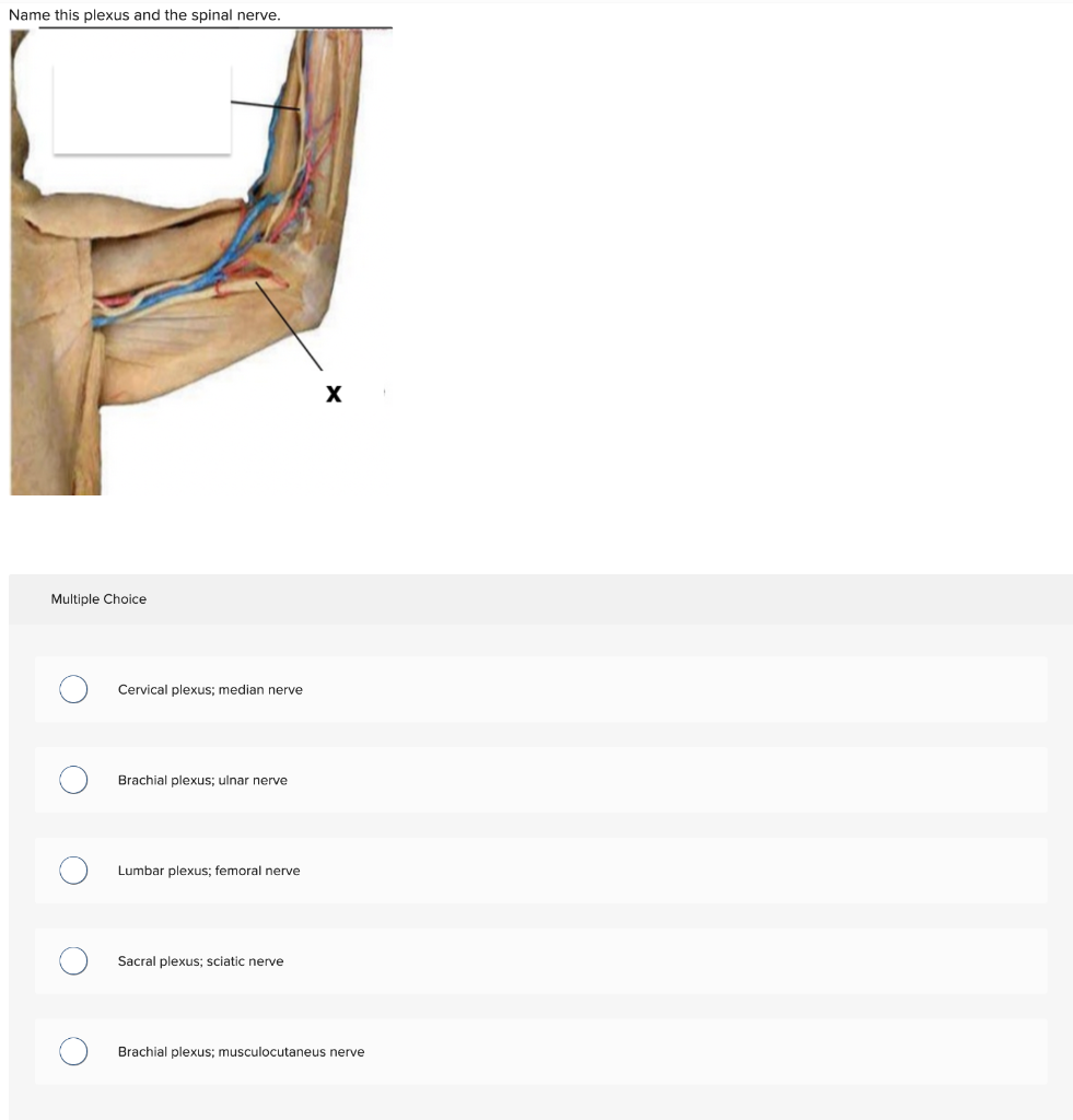 Solved Name this plexus and the spinal nerve. Multiple | Chegg.com