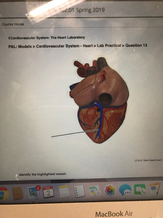 Solved HAN 202.01 Spring 2019 Course Home Cardiovascular | Chegg.com