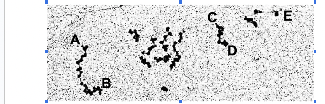 Solved Consider this electron micrograph image. Explain why | Chegg.com