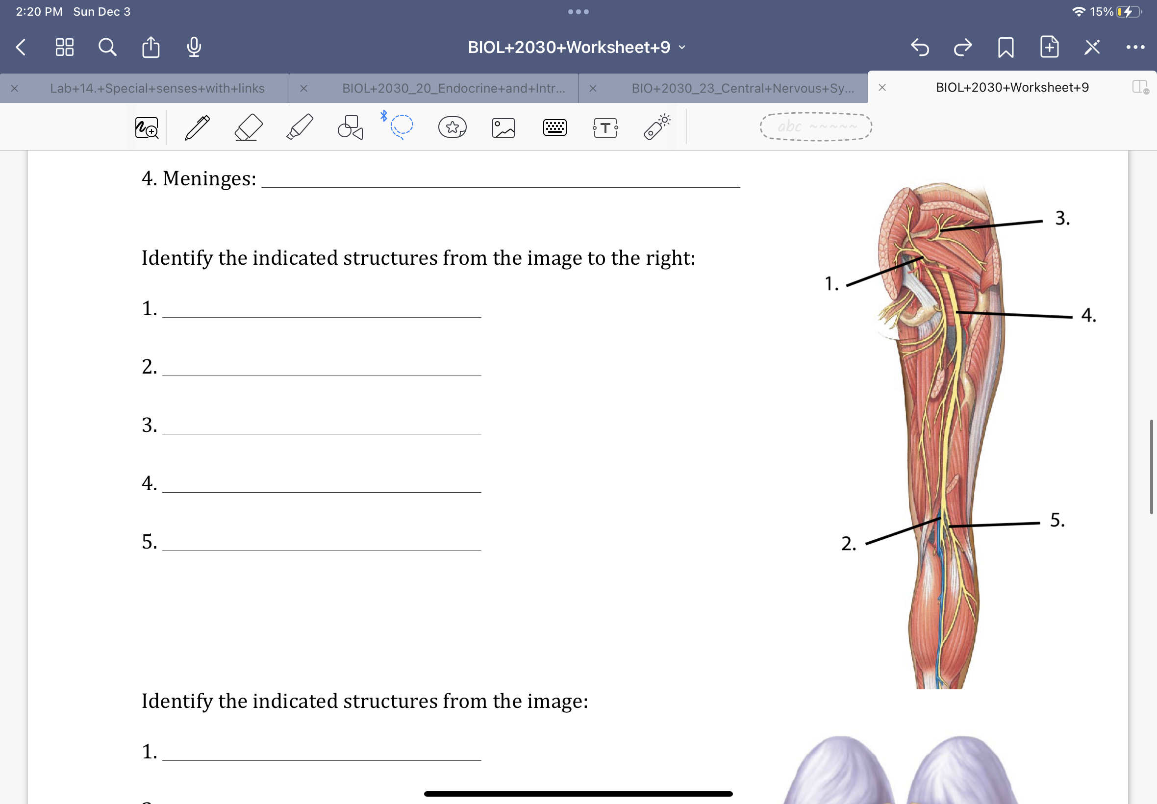 Solved 4. Meninges: Identify the indicated structures from | Chegg.com