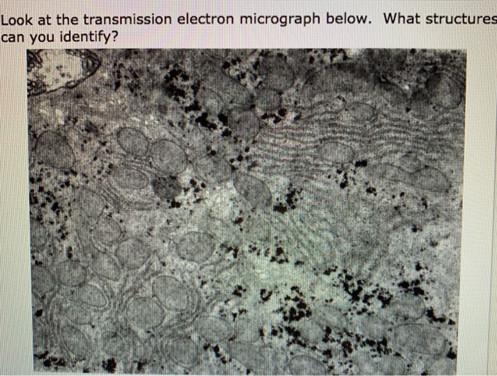 Solved Look at the transmission electron micrograph below. | Chegg.com
