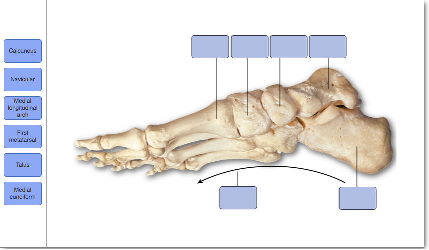 Solved Calcaneus Navicular Medial longitudinal arch First | Chegg.com