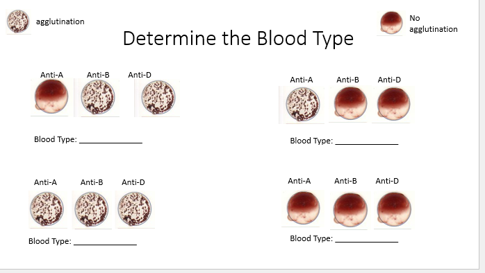 Solved agglutination Determine the Blood Type | Chegg.com