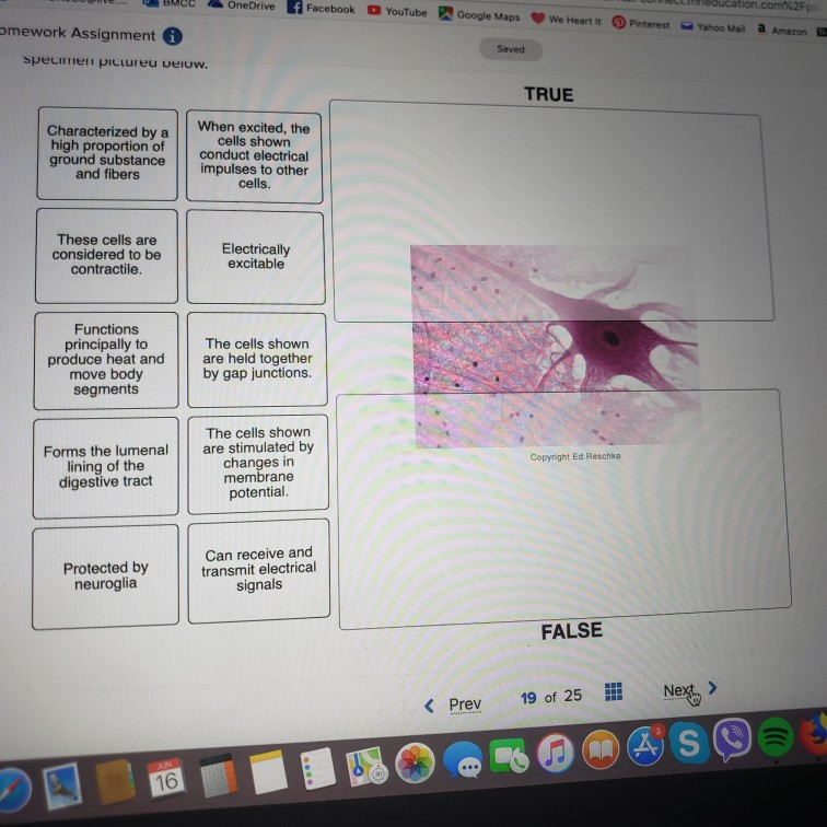 Solved apter 5 Homework Assignment Saved Chondrocyte in | Chegg.com Solved apter 5 Homework Assignment Saved Chondrocyte in | Chegg.com