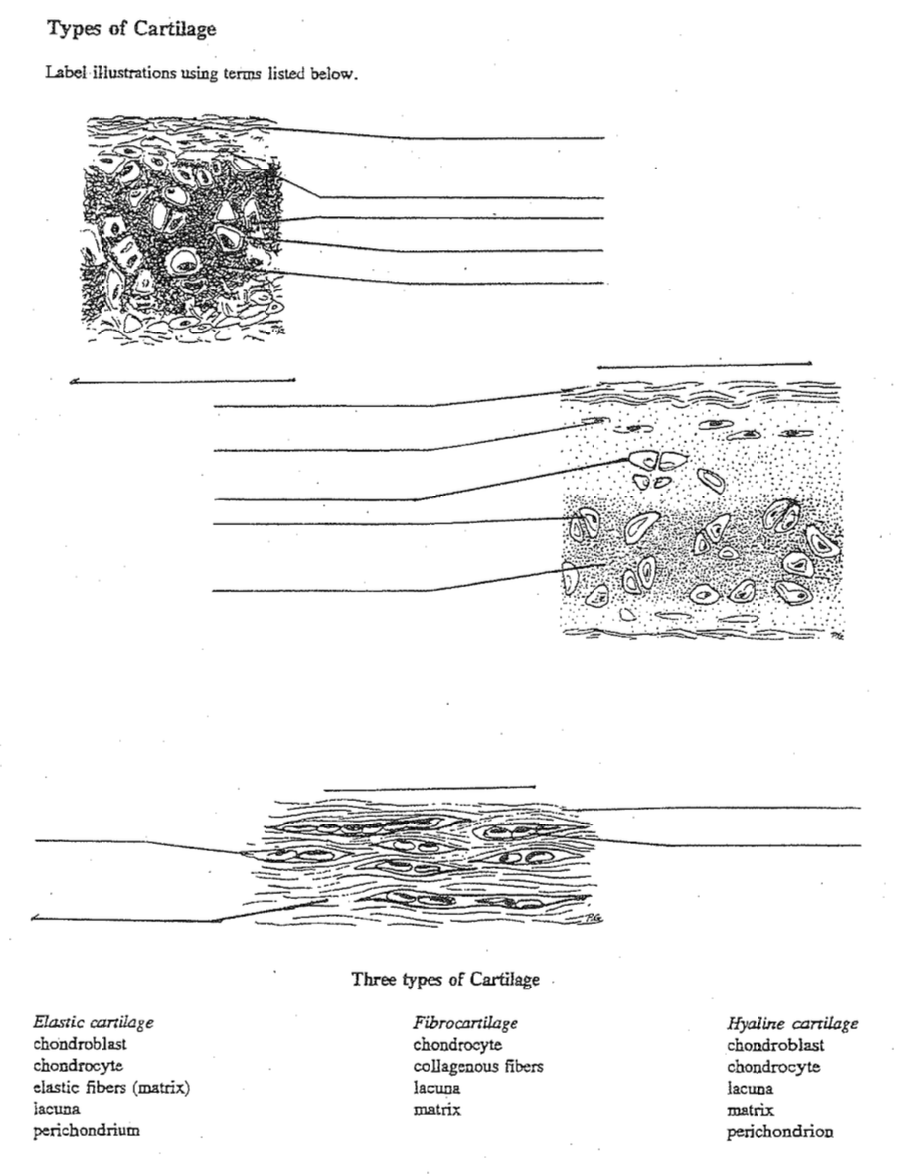 Solved Types of CartilageLabel illustrations using terus | Chegg.com