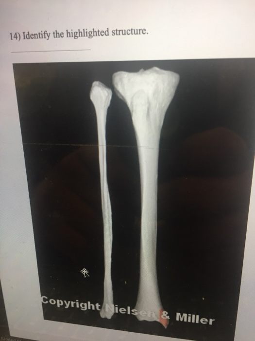 Solved 1) Identify the highlighted area of the following | Chegg.com