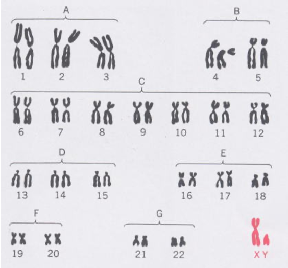 Solved Examine the following karyotype carefully. Label | Chegg.com