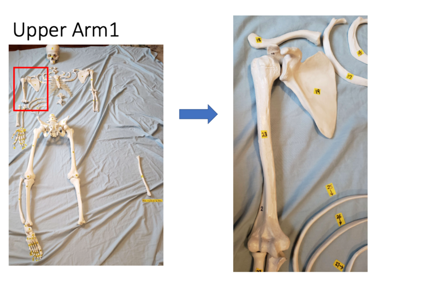 Solved Upper Arm1 | Chegg.com