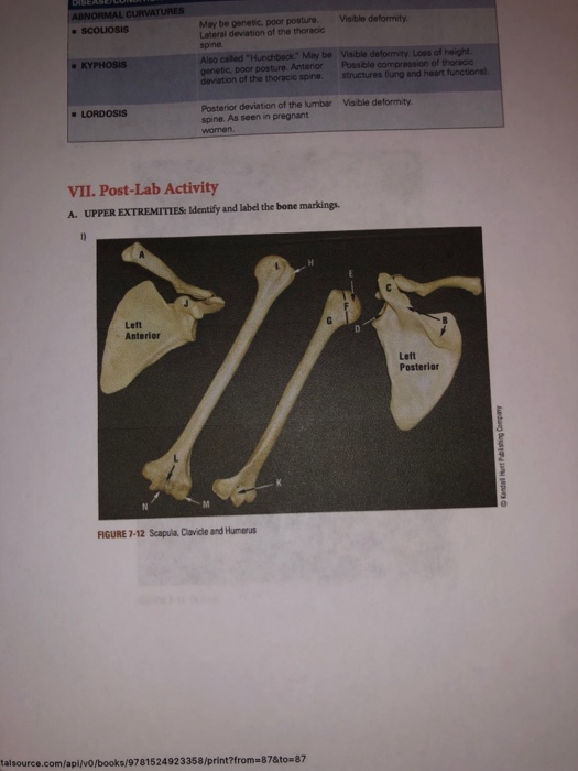 Solved R. Complete this table describing bone classification | Chegg.com Solved R. Complete this table describing bone classification | Chegg.com