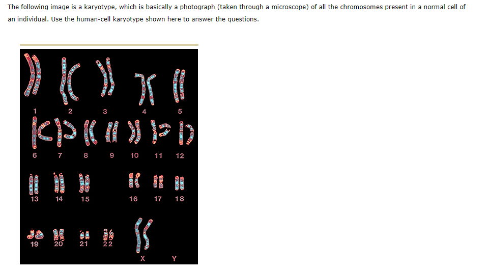 Solved The following image is a karyotype, which is | Chegg.com