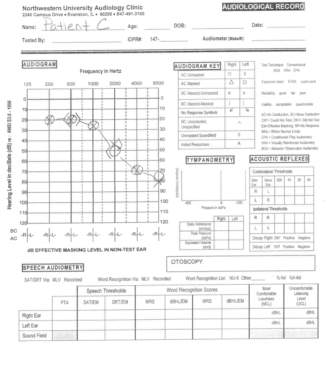 Solved I have posted 3 partial, fictional audiograms. Each | Chegg.com
