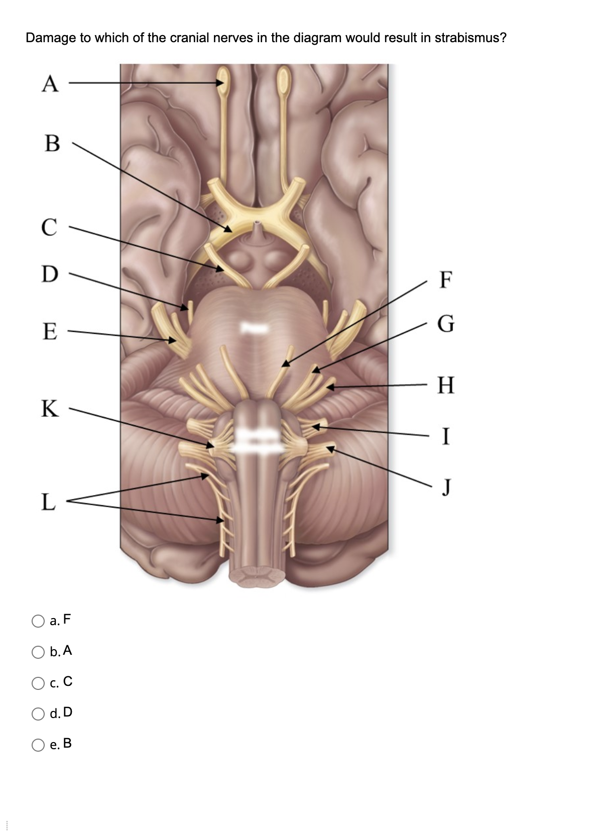 Solved Damage to which of the cranial nerves in the diagram | Chegg.com